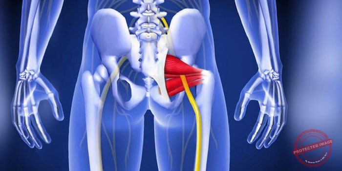 ¿Qué es el Síndrome del Piriforme? - Elisa Moreno